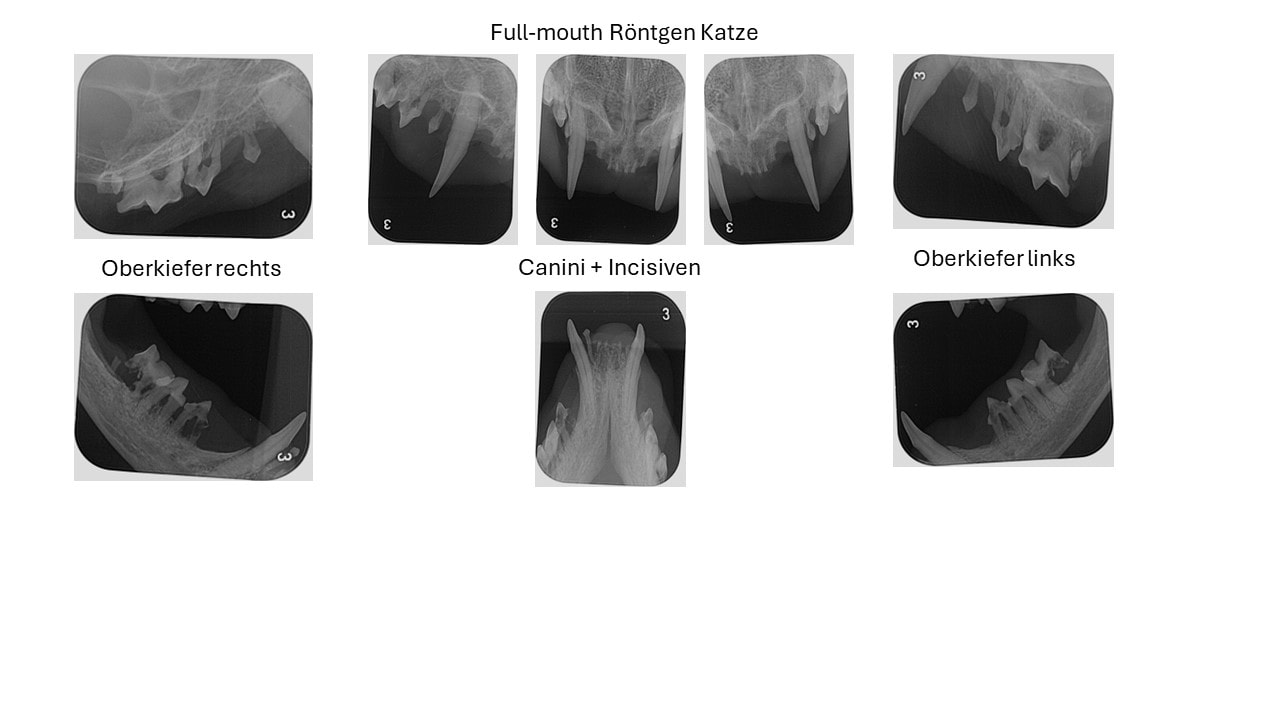 MT: FORL und CORL: Diagnose und Behandlungsmethoden